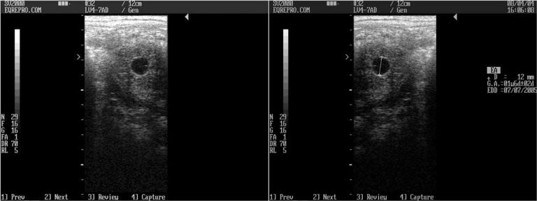 First Steps in Breeding a Mare • Equine-Reproduction.com, LLC