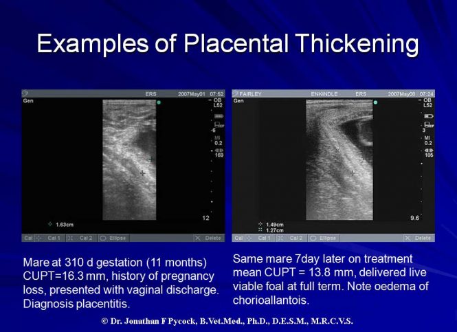 Placentitis in the Mare - diagnosis and treatment