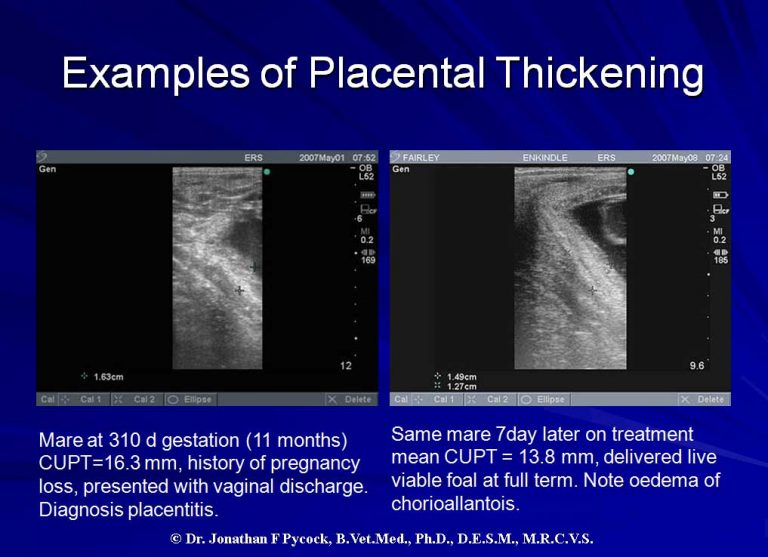 Placentitis in the Mare - diagnosis and treatment